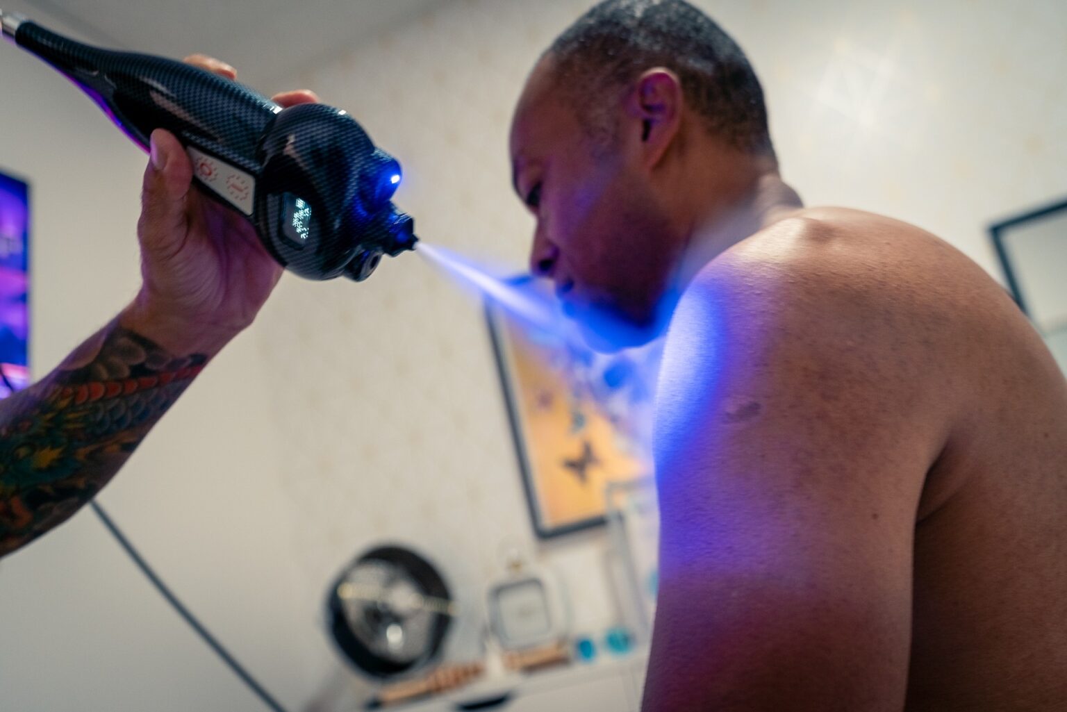 Sub-Zero Localized Cryotherapy in Rancho Peñasquitos | Targeted Pain Relief